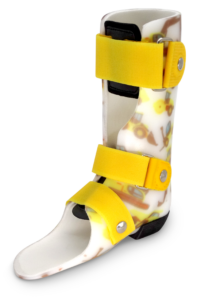 Pediatric AFOs - Hanger Fabrication Network