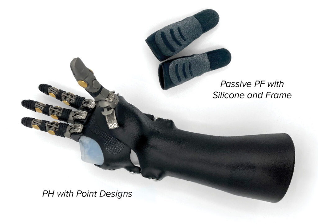 Upper Extremity Prosthetics - Hanger Fabrication Network
