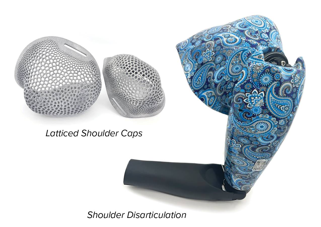 Upper Extremity Prosthetics - Hanger Fabrication Network